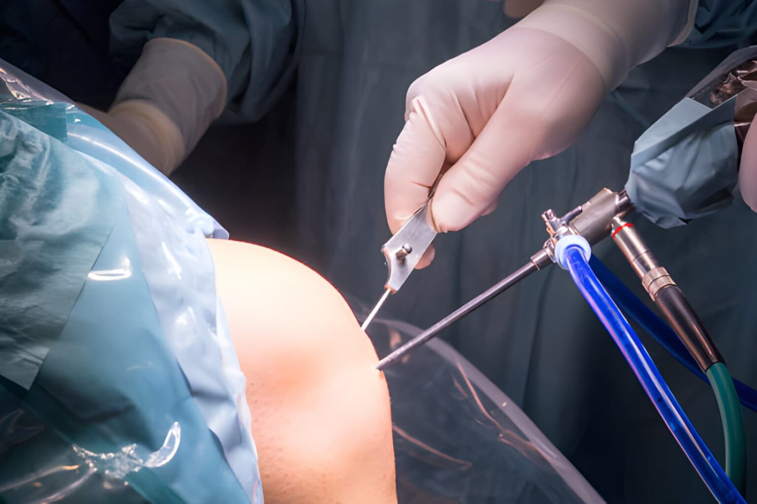 Why Choose an Orthopaedic Surgeon for ACL Reconstruction?